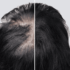Physical Hair Properties Explained: Hair Density, Diameter, Ellipticity ...