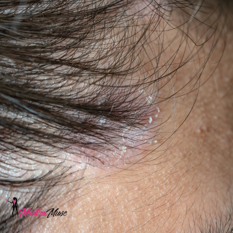 The Transformative Power Of Ceramides In Hair Products | The Mestiza Muse